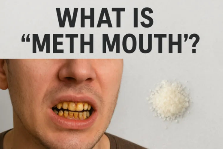 What Is “Meth Mouth”? Can You Fix Your Teeth after Drug Use?What Is ...